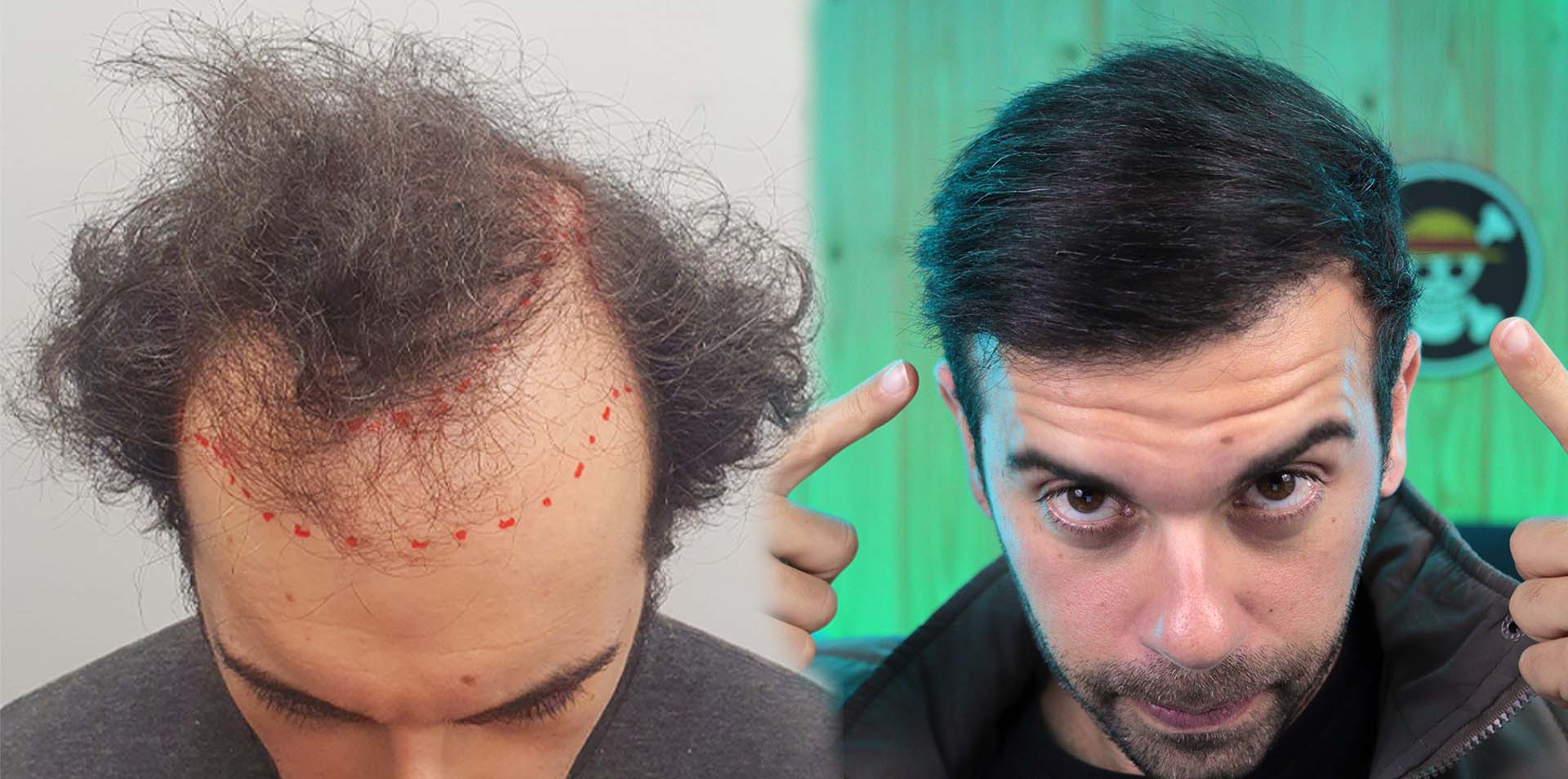 Francisco Honorato | Calvície, e-book para manutenção capilar